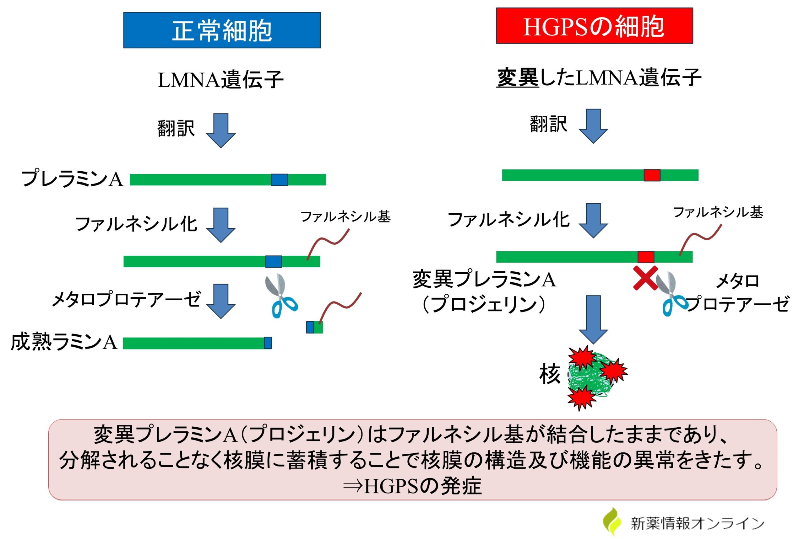 ゾキンヴィ（ロナファルニブ）の作用機序・特徴【HGPS】 - 新薬情報オンライン