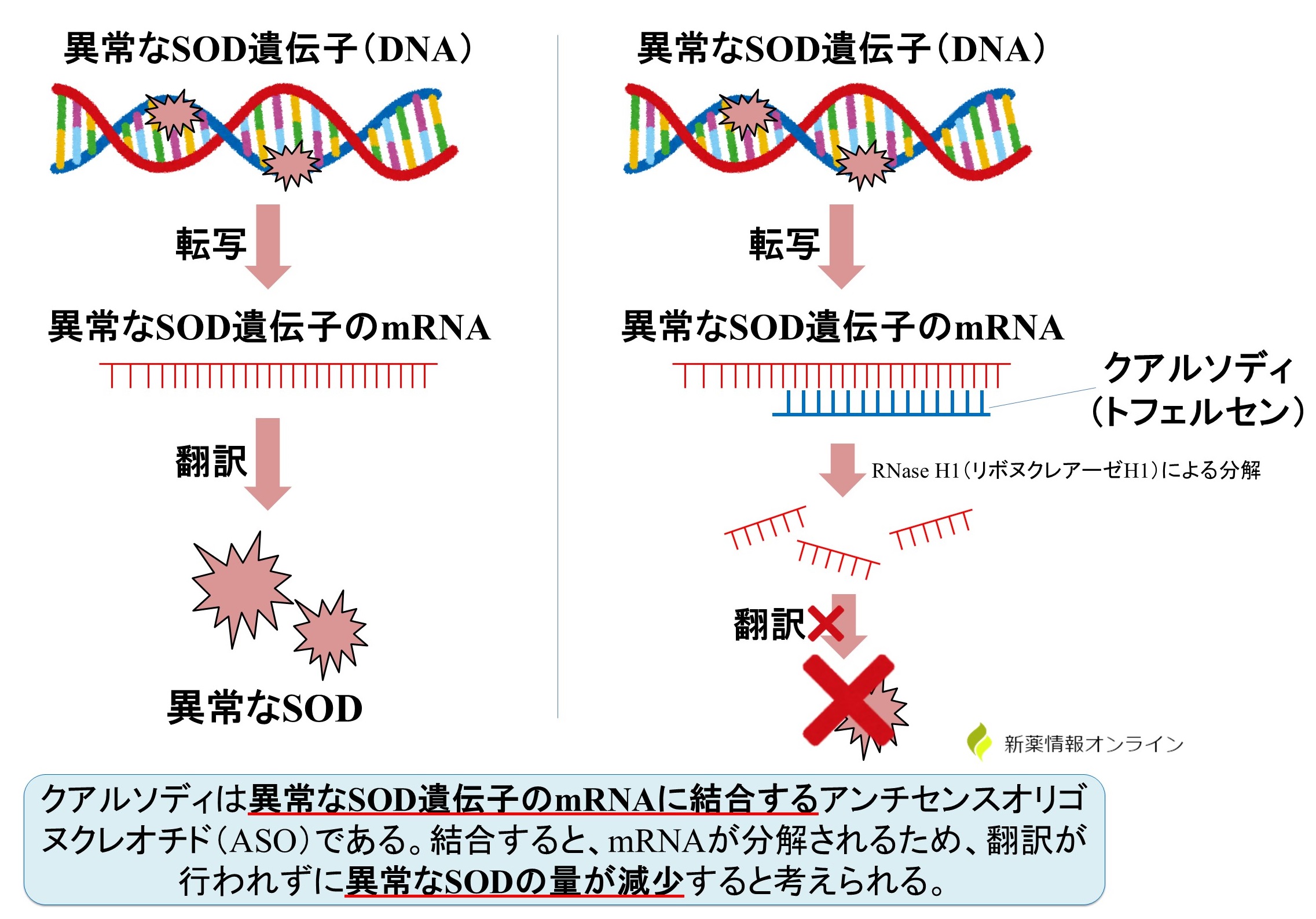 クアルソディ髄注（トフェルセン）の作用機序【ALS】 - 新薬情報オンライン